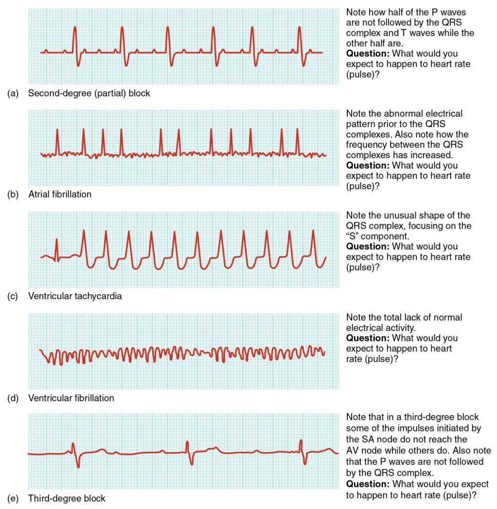 ECG Master Black Belt- Med On Wheels. Quality Home Health Care